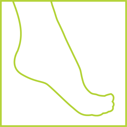 seg-way endoscopic carpal tunnel release (ECTR) System - Trice Medical