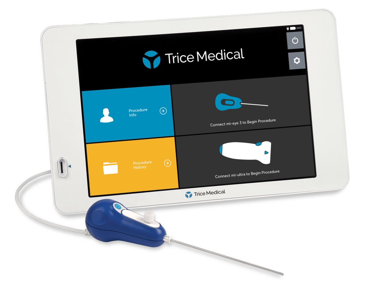 single use carpal tunnel release system - Trice Medical