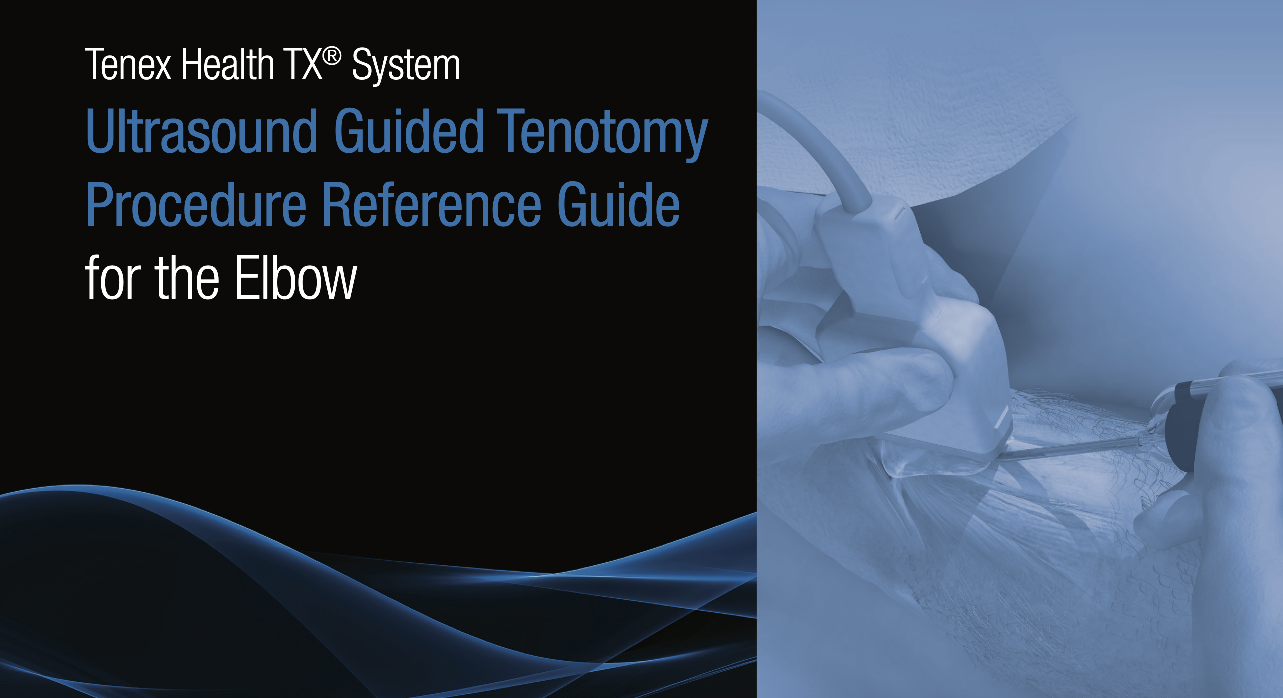 Procedure Reference Guide Elbow (MKT-383) - Trice Medical