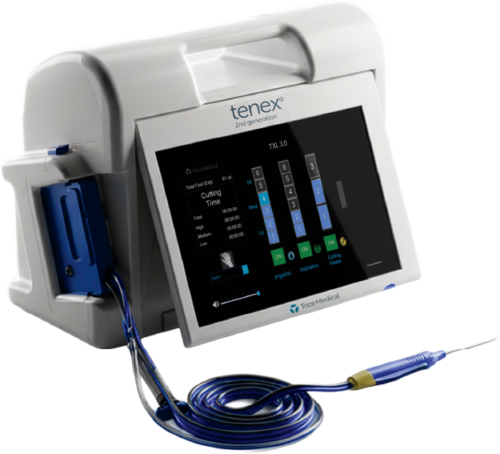 TRICE MEDICAL LAUNCHES TENEX® 2ND GENERATION ULTRASONIC SYSTEM ...